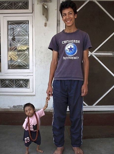 .: StoriesFromAroundTheWorld :.: Smallest Man In India