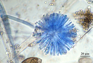 Especies de Polchaco: Syncephalastrum sp.