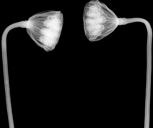 Ultimate Examples of X-Ray Photography by Nick Veasey | ~Spicx~