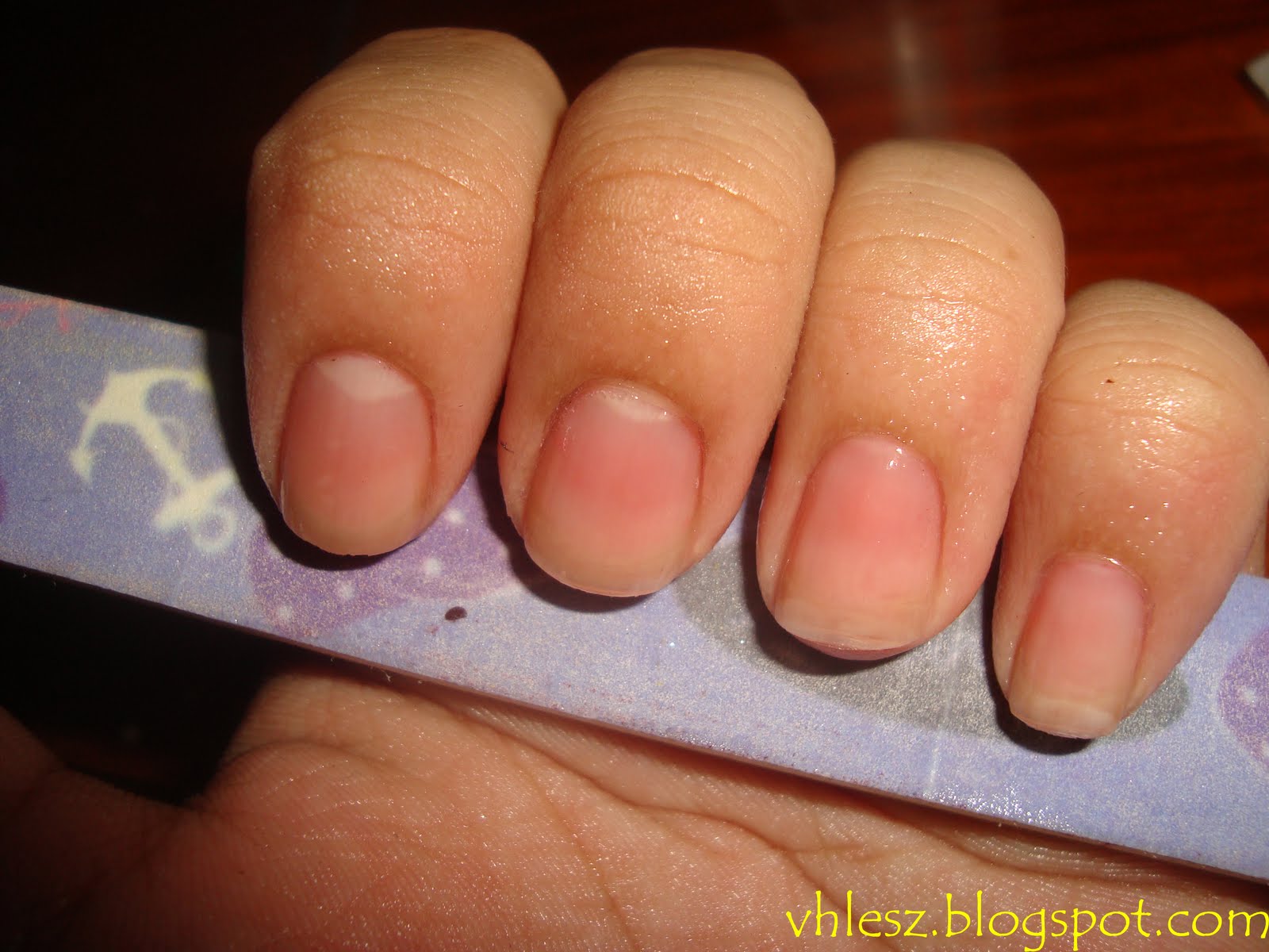 My Colorful Nailart: Dealing with cracked nails