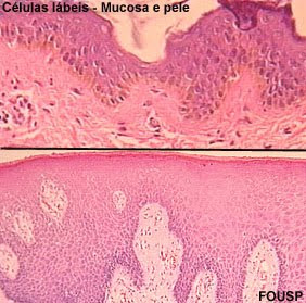 Mostra de Patologia: REGENERAÇÃO