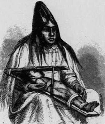 PICS DOT COM: Deformation of the Human Skull