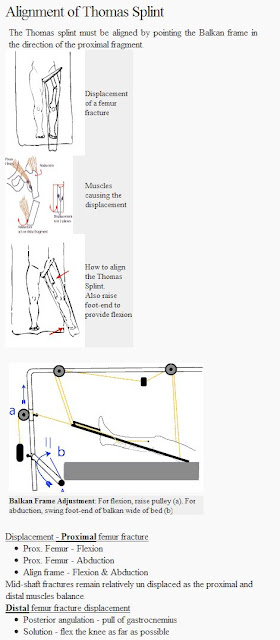 Orthopaedics Mcqs Postgraduation entrance preparation: 75 - Thomas splint