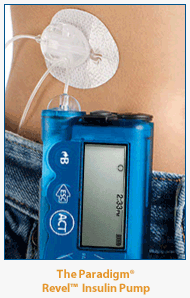 The Jonas Blog: Definitivo! Nick jonas ya no usa el omnipod..