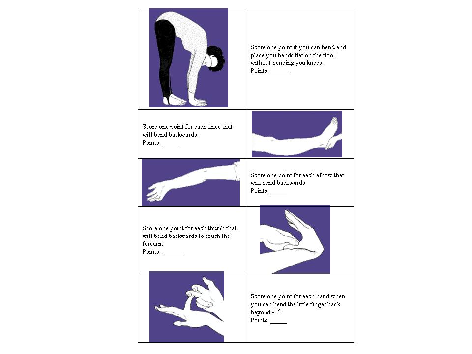 Highly sensitive amygdalas and double jointedness : r/hsp