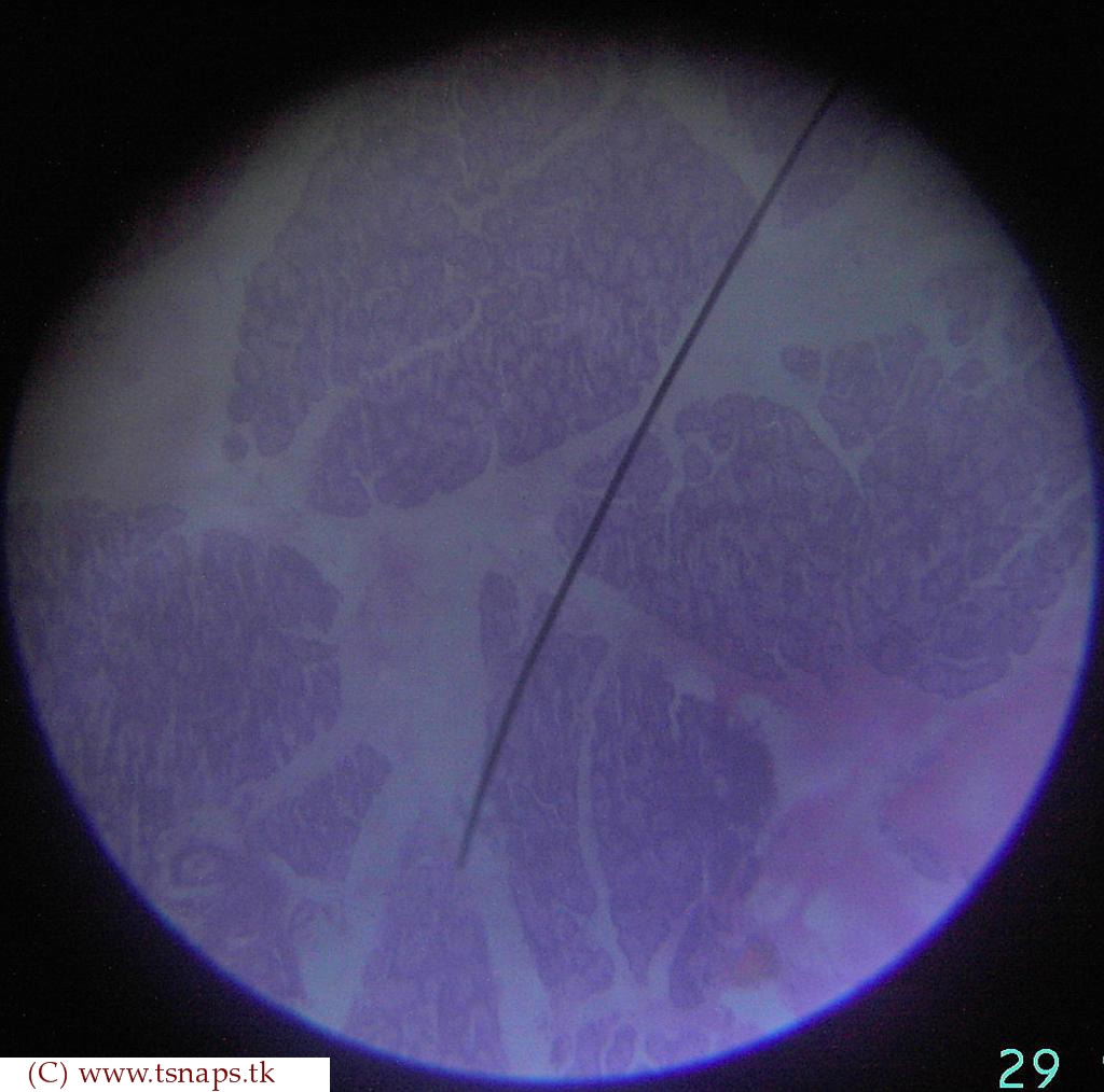Histology Slides Database: mucous acini(mucous acinus) histology slide