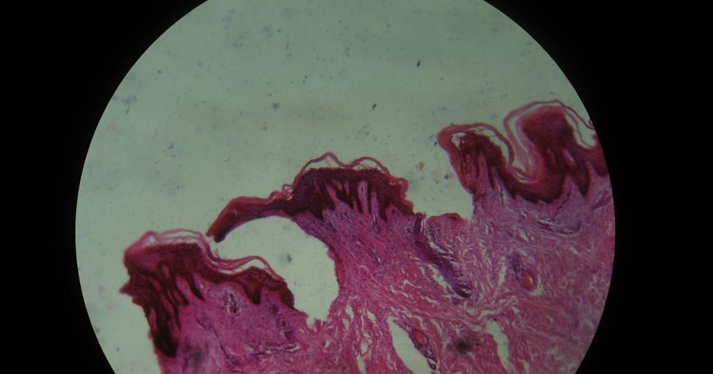 Keratinized Stratified Squamous Epithelium Slide
