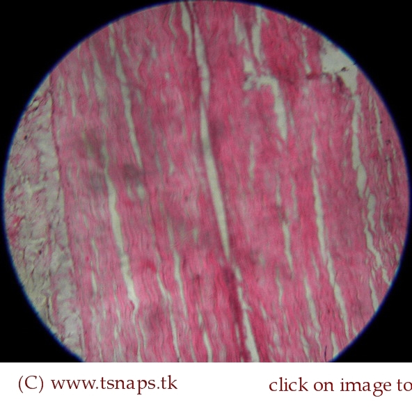 Histology Slides Database: dense regular connective tissue (tendon ... Histology Slides Database: dense regular connective tissue (tendon ...