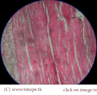 Histology Slides Database: dense regular connective tissue (tendon ...