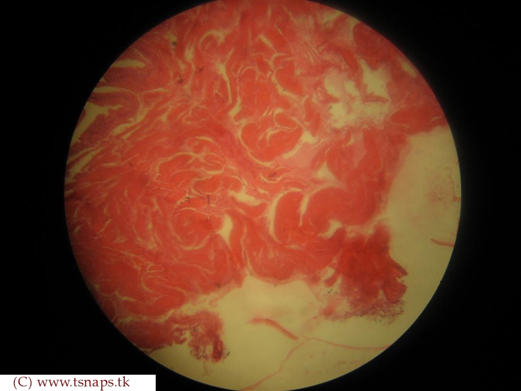 Histology Slides Database: Urinary bladder histology slides