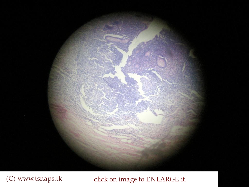 Histology Slides Database: appendix histology slides