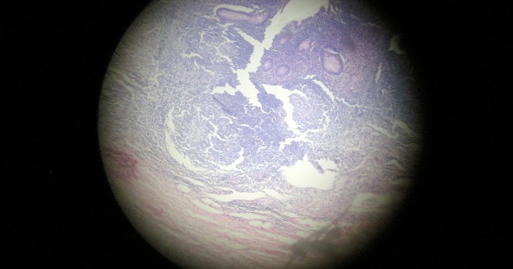 Histology Slides Database: appendix histology slides