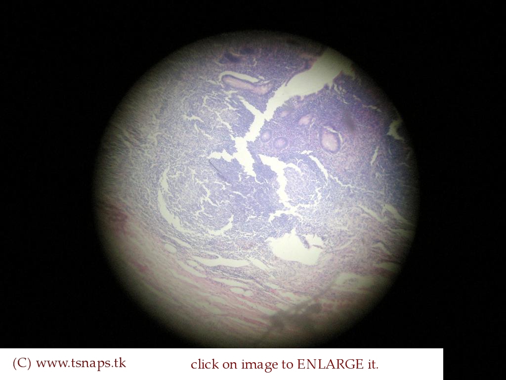 Histology Slides Database: appendix histology slides