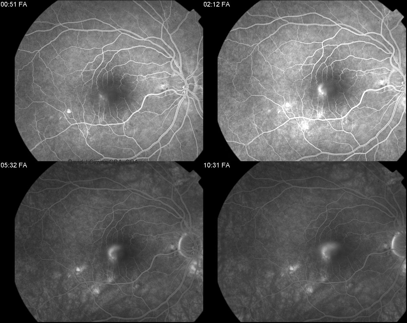 Retinal Photography & Optical Coherence Tomography