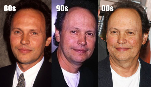 Jodie Marsh Bodybuilder Tattoos: Billy Crystal Plastic Surgery Rumors