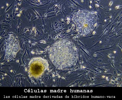 células madre embrionarias | Crio Cord