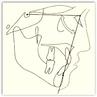 DOCENCIA ODONTOLOGICA: CEFALOMETRIA DE STEINER