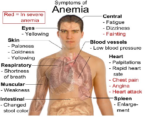 anemia symptoms | chemical elements