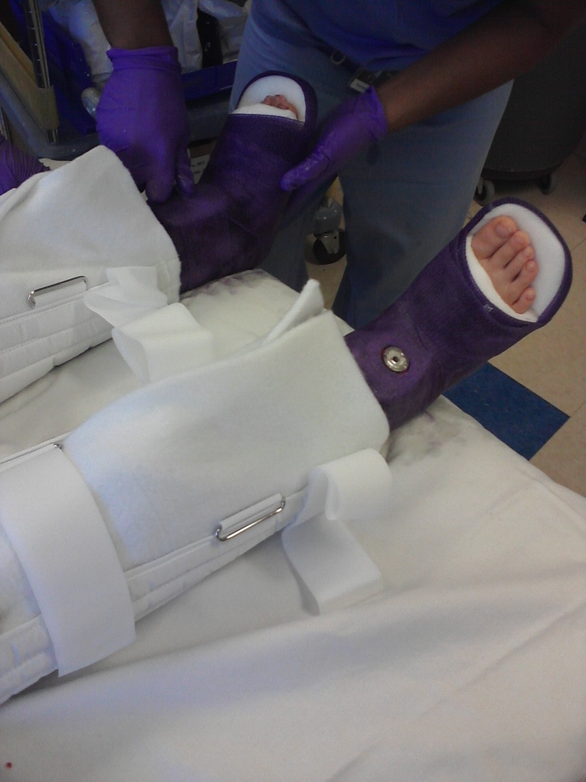 Wilkins World: Pictures of Zeke's Legs During Casting