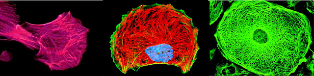 el Blog del Profe de Biolo: ﻿El Citoesqueleto