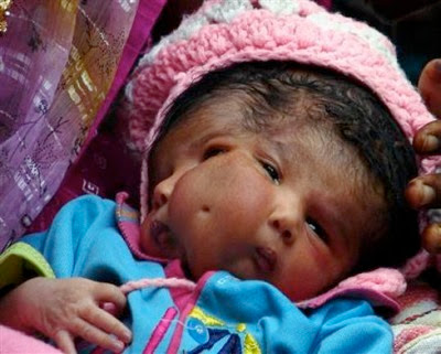 Top 10 Bizarre Medical Anomalies ~ Extraordinary Thing