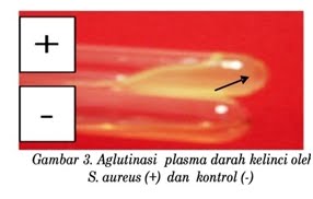 Analisis Kesehatan: Makalah tentang Staphylococcus Aureus