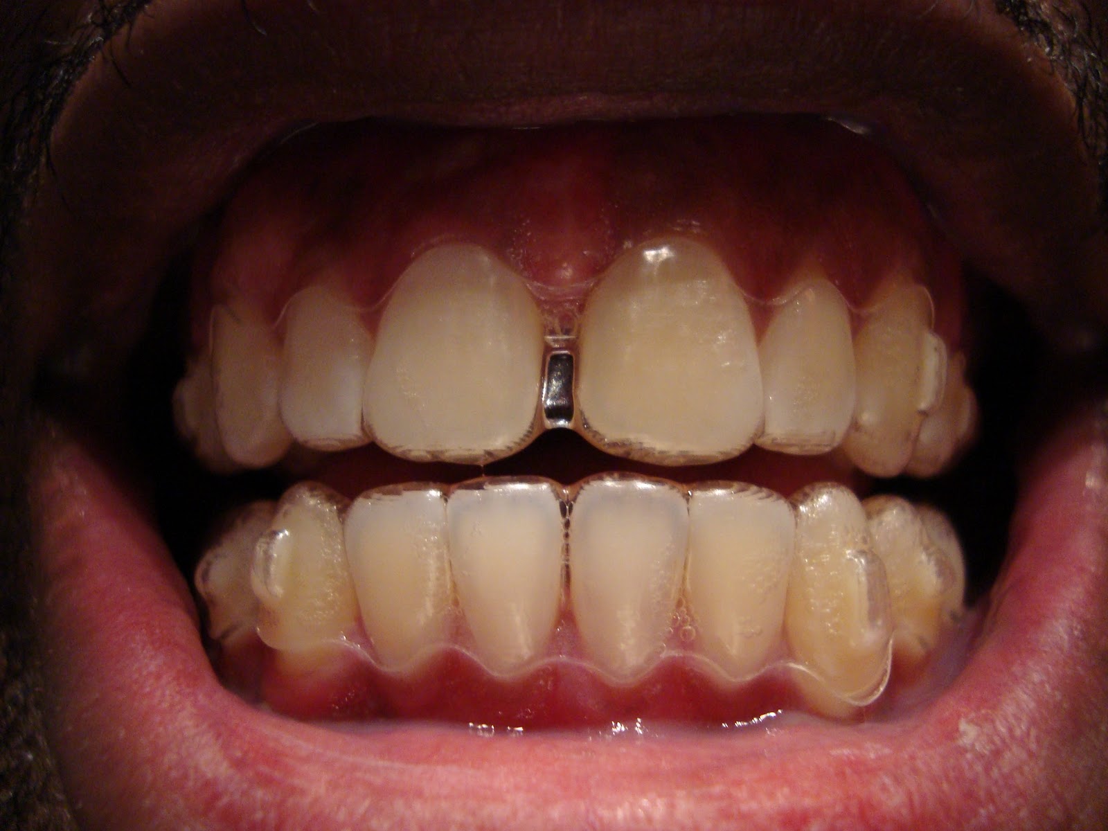 tray 20