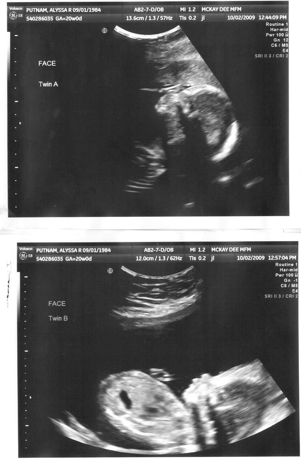 Tyler and Lissy: 20 Week Ultrasound pics!