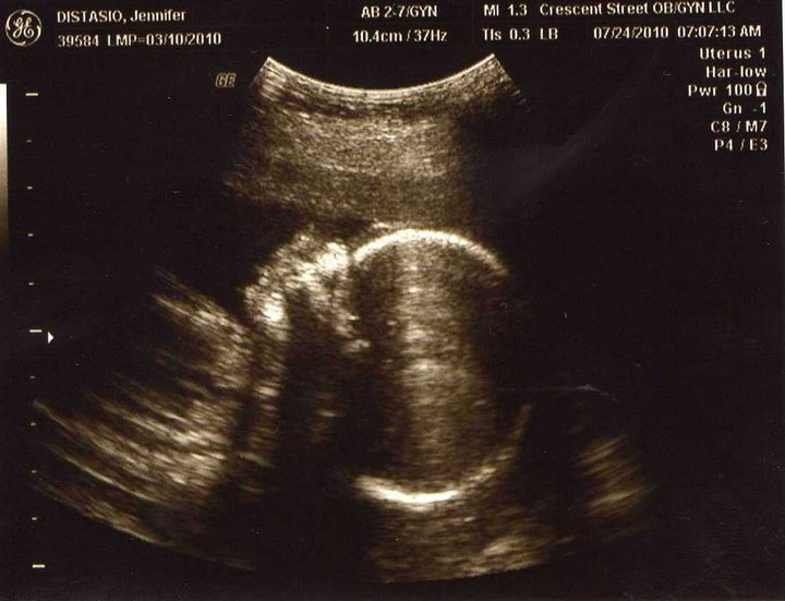Operation FIND Me: Our Ultrasound 19 weeks 7/24/2010