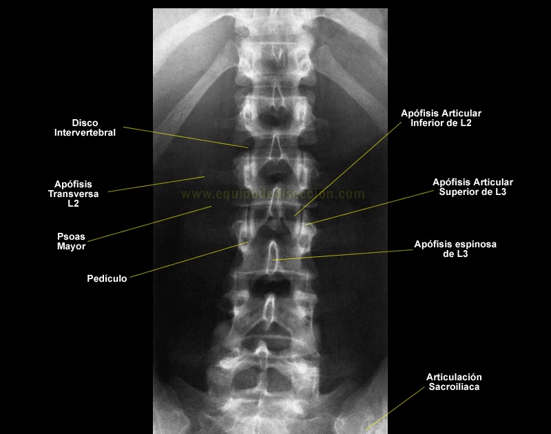 rx: Rx Frente Columna Lumbar