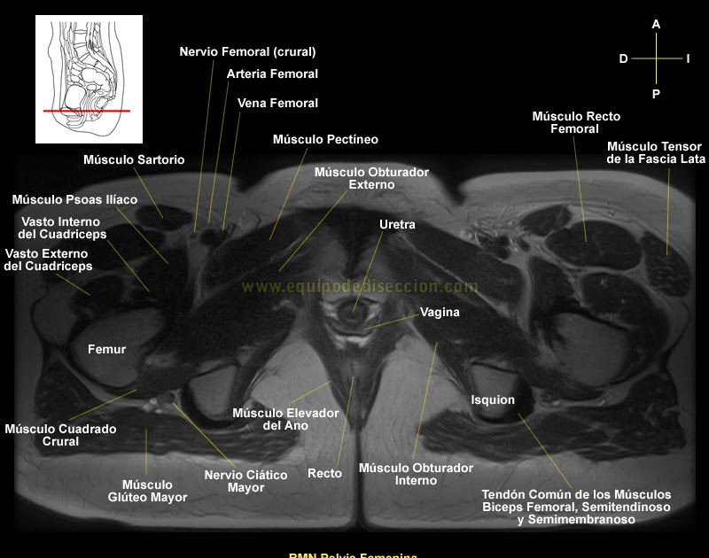 RMN: RMN pelvis femenina Nº1 corte transversal