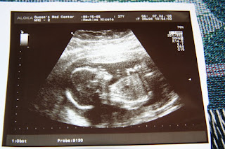 Tim & Nicole: 5 month Ultrasound Picture & Baby Bump