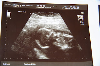 Tim & Nicole: 5 month Ultrasound Picture & Baby Bump