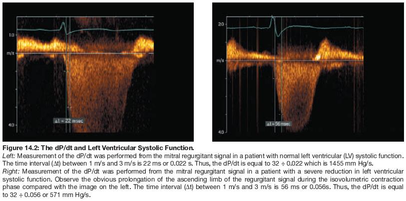 Normal Lv Size And Systolic Function | semashow.com