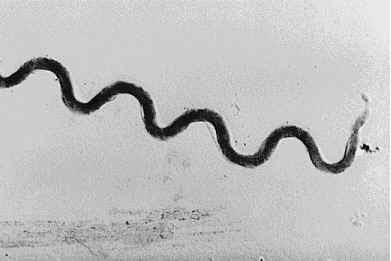 BiologiBLOG (Paty Ovalle): Treponema pallidum