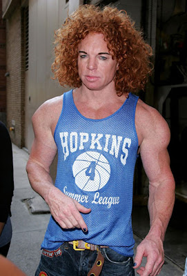 Sassy Molassy: The Man Whose Arms Exploded