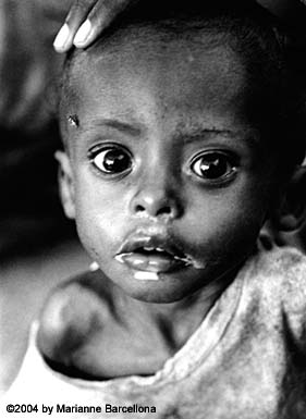 They Starve From Hunger!!!: Hungry Children Pics