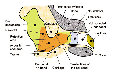 M.R.O.: How deep do you insert your ER4?