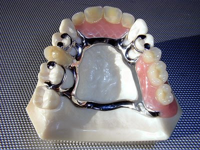 prot.moraes: Próteses dentarias