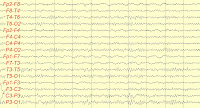 NEUROLOGY INVESTIGATIONS: Aug 17, 2008