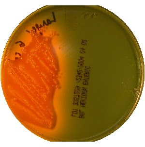 Biochemical Tests: Hektoen Enteric Agar