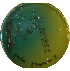 Hektoen enteric agar - Alchetron, The Free Social Encyclopedia