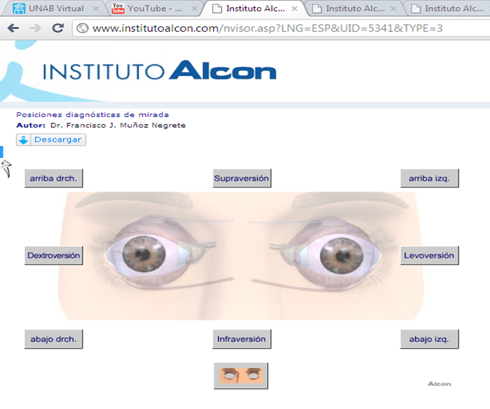 OVA PARA EL DIAGNÓSTICO DE MÚSCULOS EXTRAOCULARES