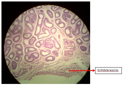 LABORATORIO DE HISTOLOGIA: Aparato Reproductor Masculino