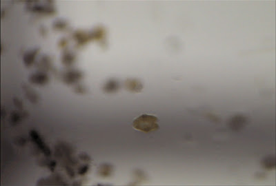 Encyclopedian Dictionary ( Akashiwo Sanguinea ): Akashiwo sanguinea ...