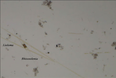 Encyclopedian Dictionary ( Coscinodiscus - Diatom ): Coscinodiscus ...