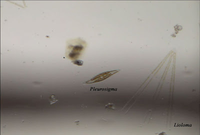 Encyclopedian Dictionary ( Pleurosigma ): Pleurosigma and Lioloma (Salt ...