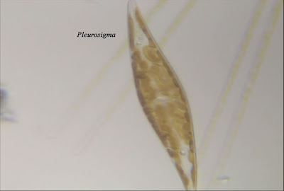 Encyclopedian Dictionary ( Pleurosigma ): Pleurosigma and Lioloma (Salt ...