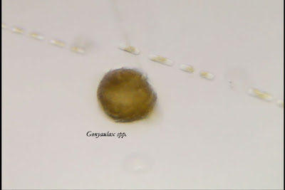 Encyclopedian Dictionary ( Gonyaulax ): Gonyaulax (Dinoflagellate) #006 ...