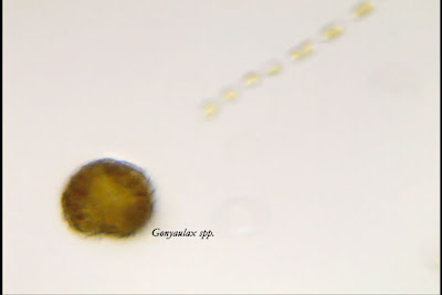 Encyclopedian Dictionary ( Gonyaulax ): Gonyaulax (Dinoflagellate) #006 ...
